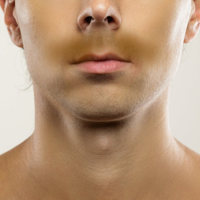 Ruddy Skin: A Guide to Healthy Skin – TMGskin.com